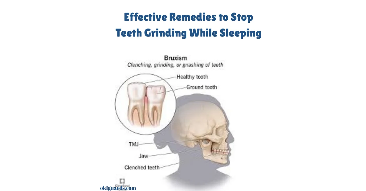 Effective Remedies to Stop Teeth Grinding While Sleeping