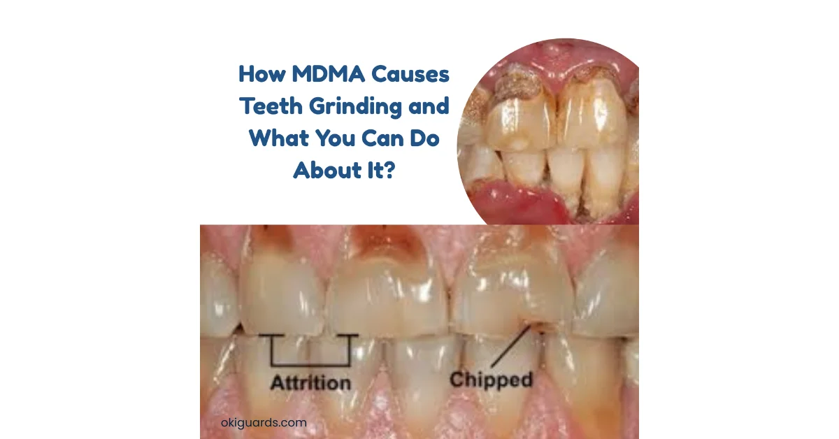 How MDMA Causes Teeth Grinding and What You Can Do About It?